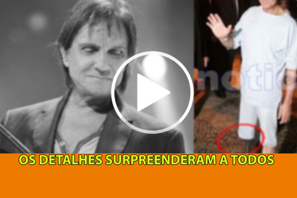 Após décadas, Roberto Carlos REVELA como perdeu a perna, familiares e ...